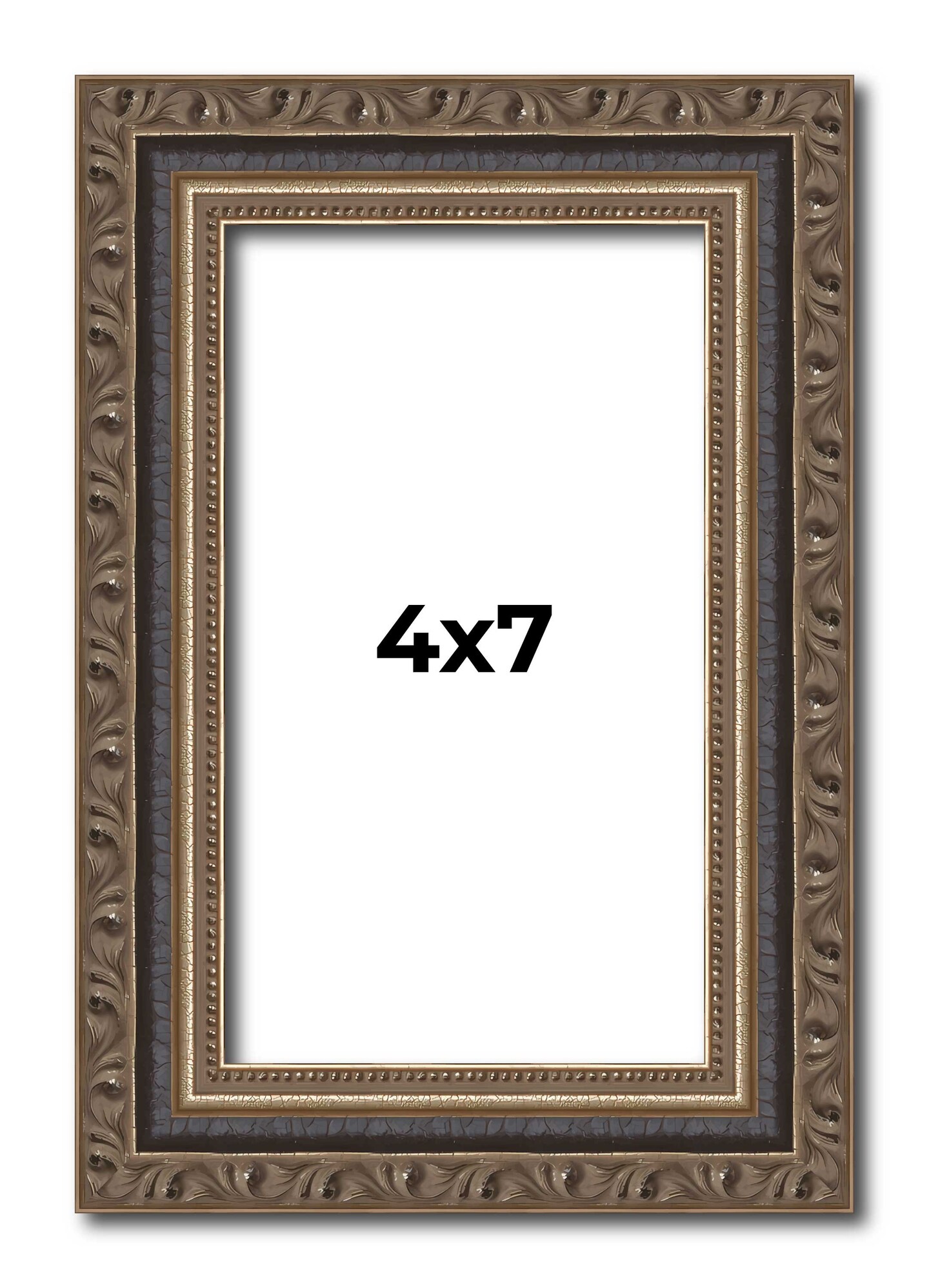Michaels ultrasound frame store